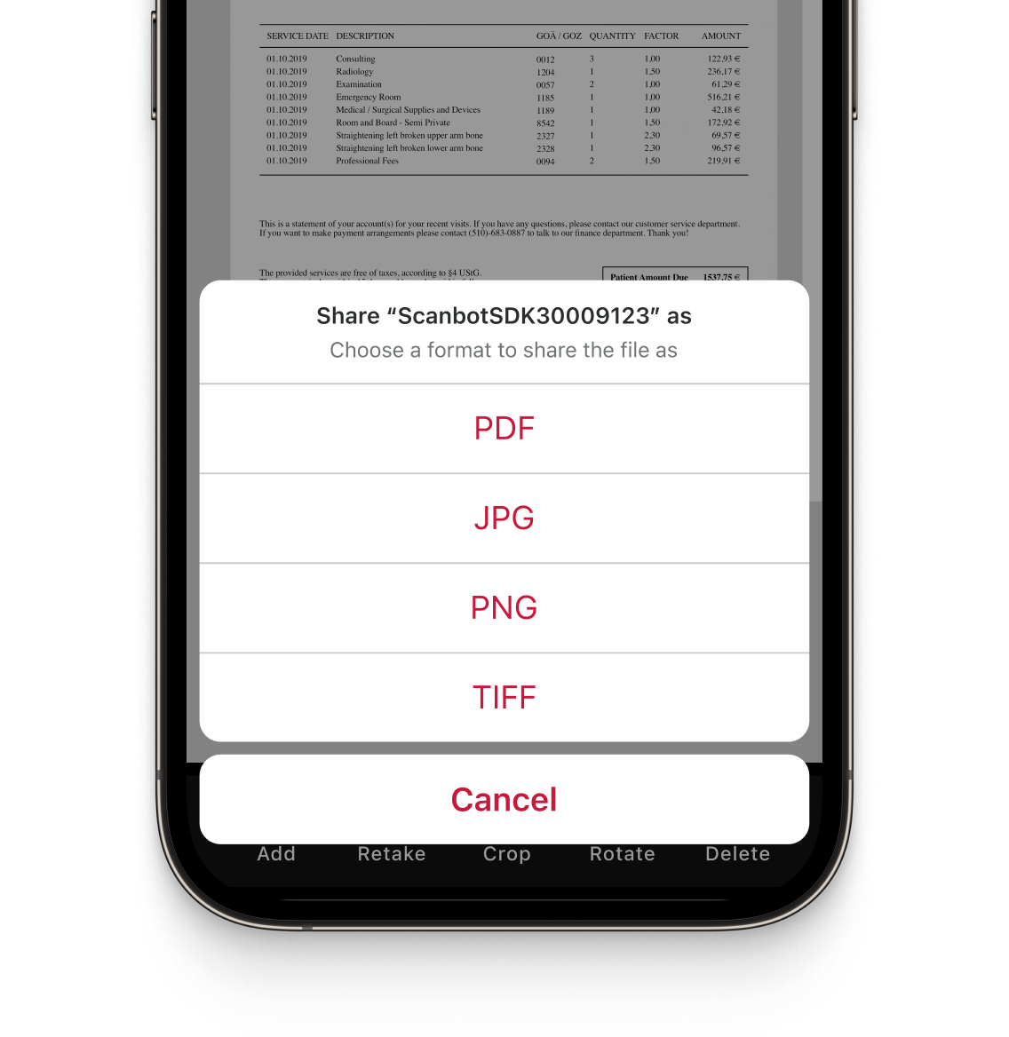 React Native Document Scanner – SDK for High-Quality Images