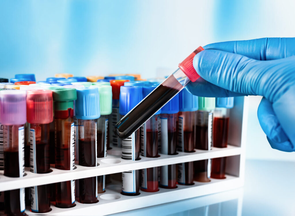 Barcodes for Accurate Lab Specimen Labels - Scanbot SDK